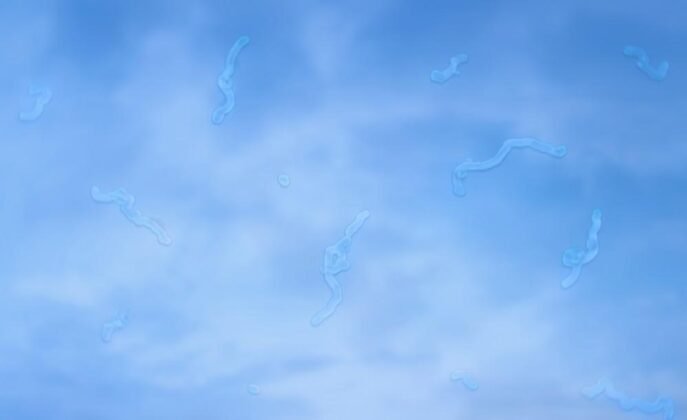 What Are Eye Floaters? Here What To Do If you Start Seeing Them ...